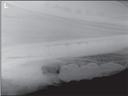 Equine Dentistry School | Case Study | Fractured upper 1st molars