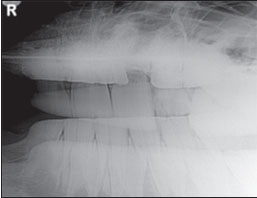 Equine Dentistry School | Case Study | Fractured upper 1st molars